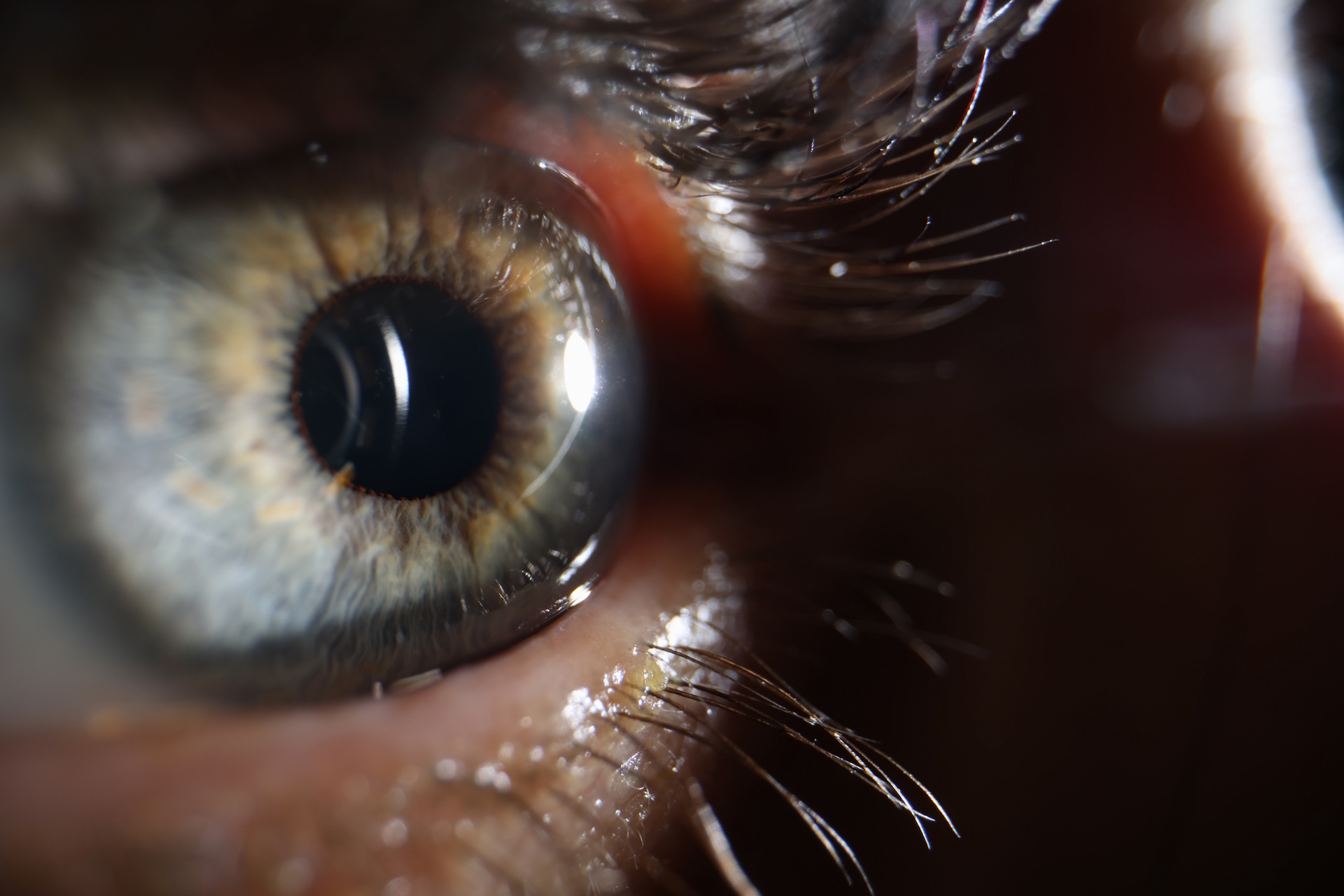 Researchers find concerning contaminant within human eyes: 'Shedding ...