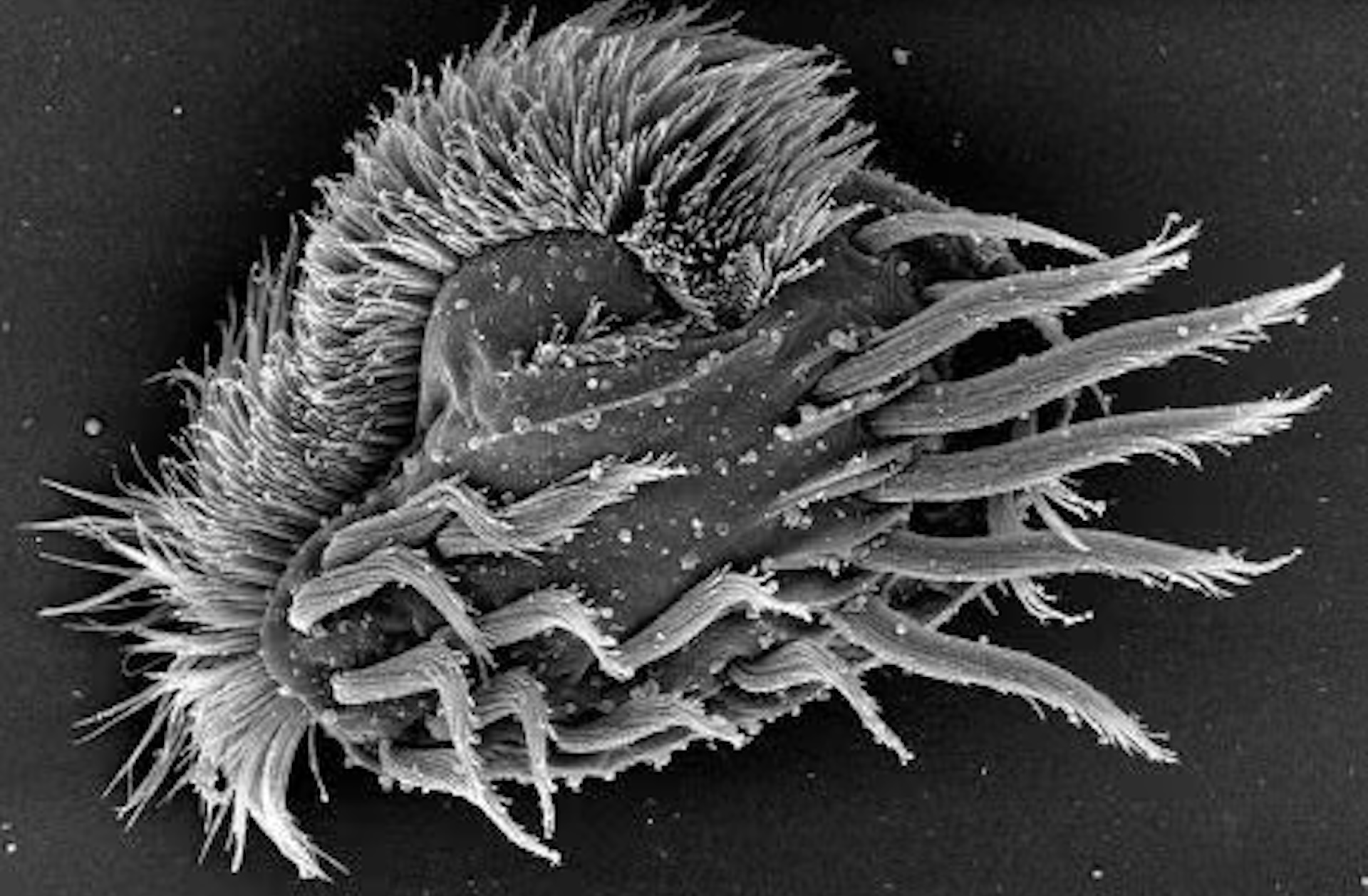 Scientists discover single-celled ‘supergiants' that hunt and swallow ...